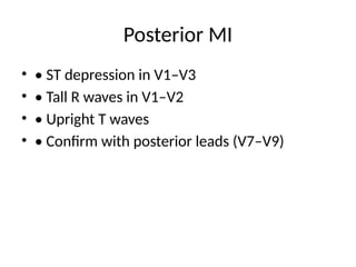 STEMI_Equivalents_PPT for mbbs er dept.pptx