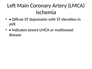 STEMI_Equivalents_PPT for mbbs er dept.pptx