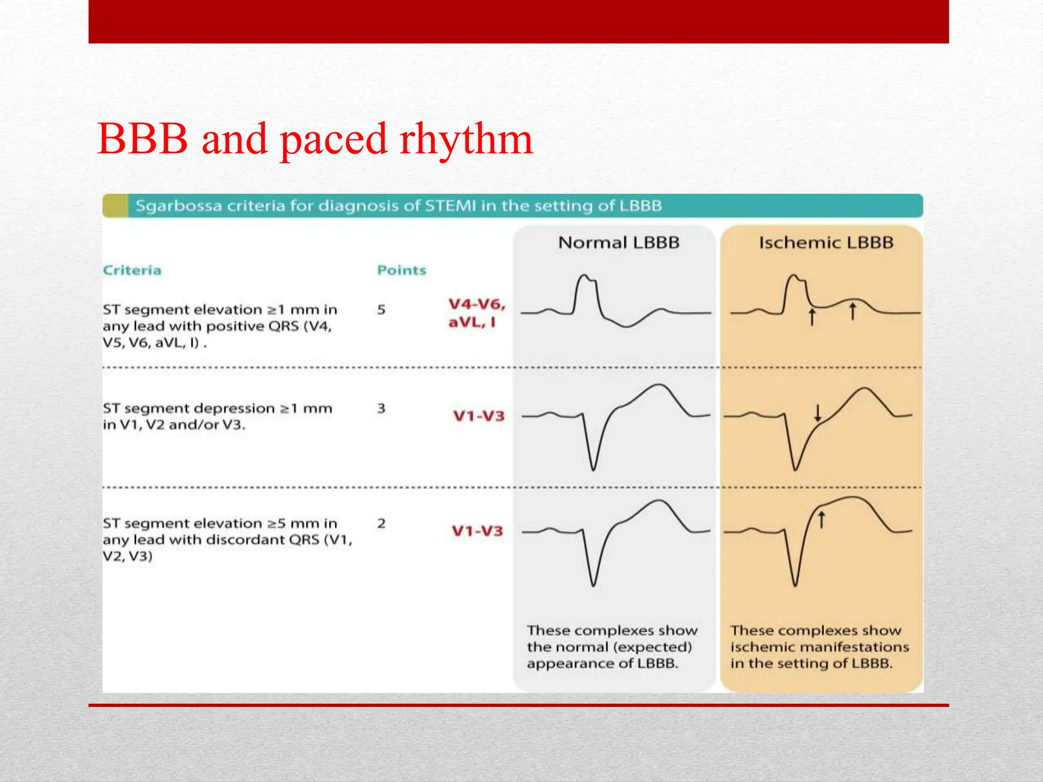 STEMI F5.pptx | First Aid | Injuries