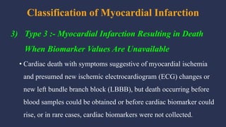 ST Elevation MI | PPTX