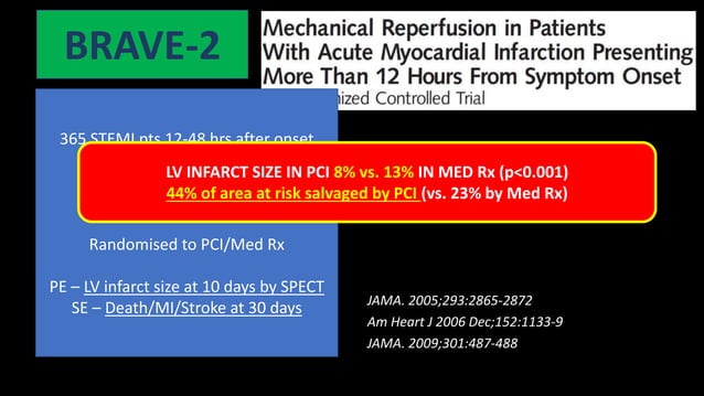 STEMI Late Presentation - Management and practical approach | PPTX ...
