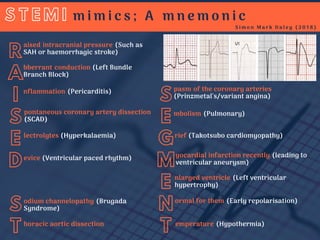 STEMI mimics; A mnemonic & a learning tool. | PDF