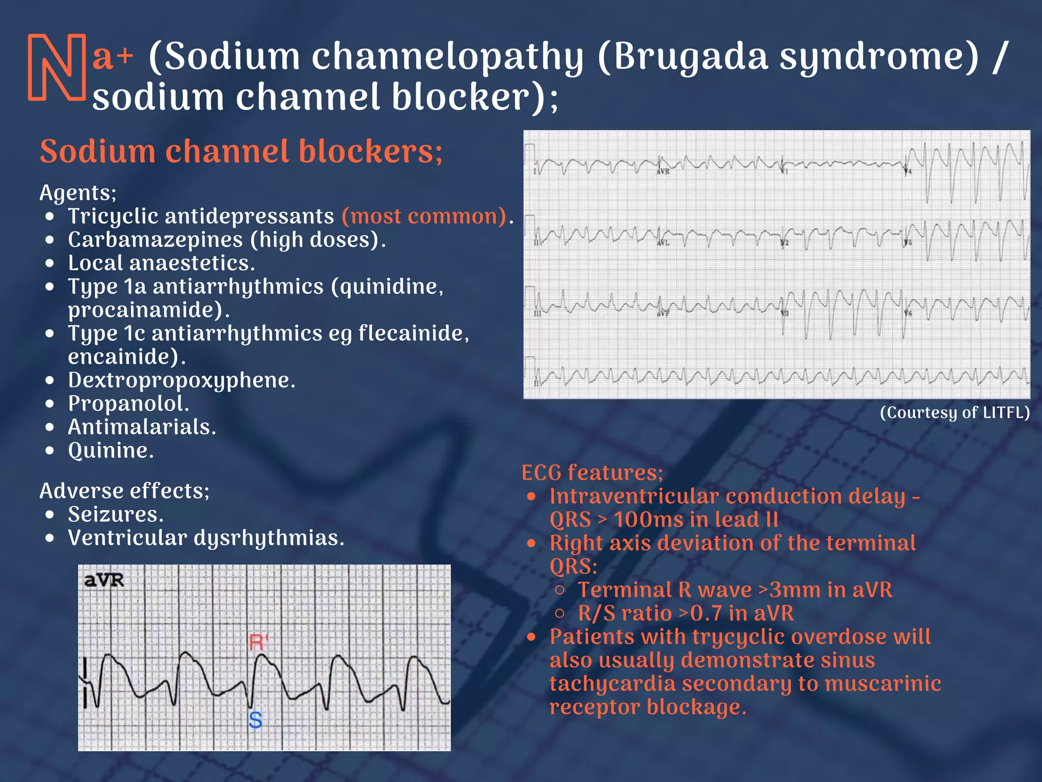 Stemi mimics v2 teaching resource | PDF