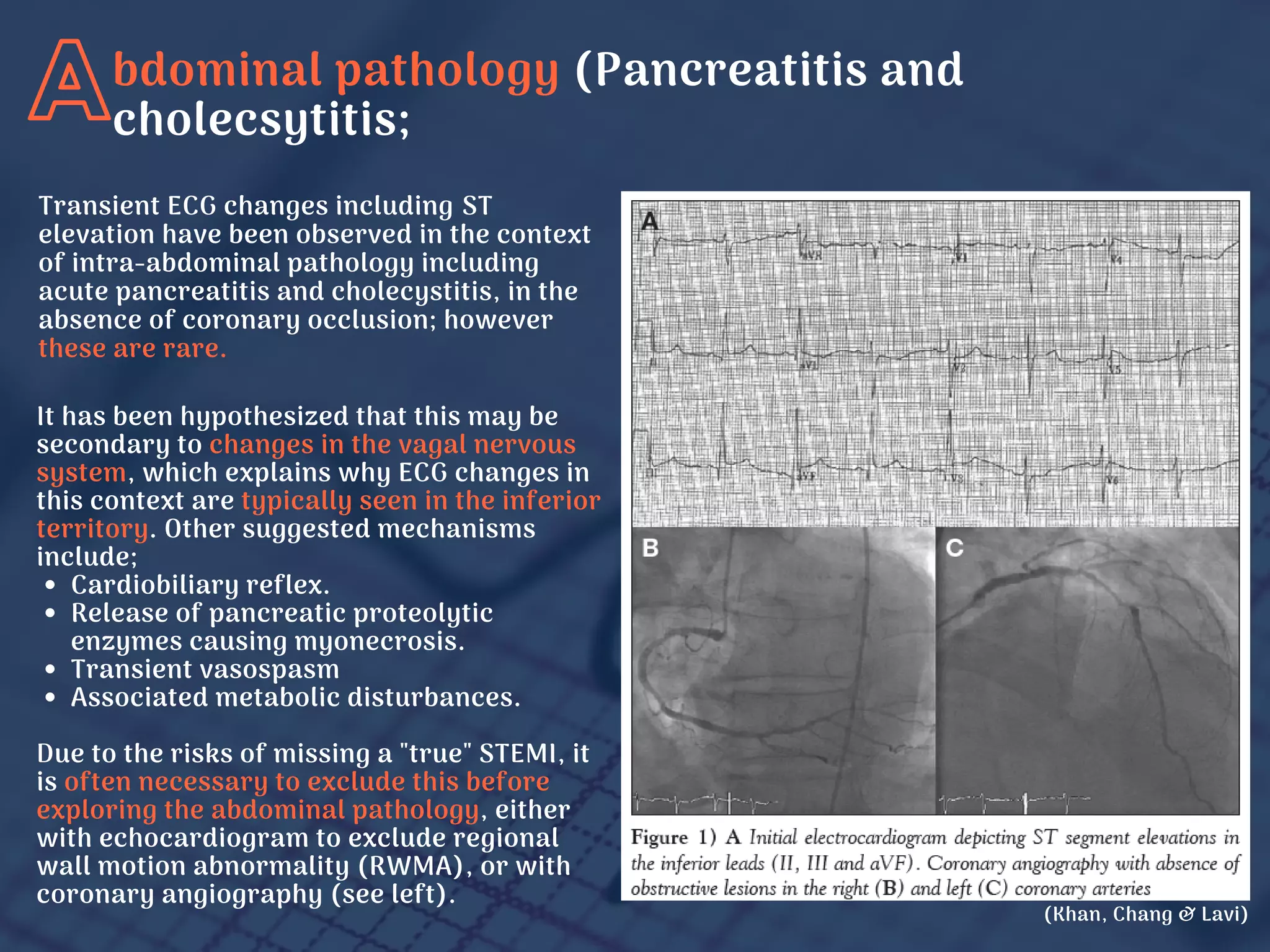 Stemi mimics v2 teaching resource | PDF