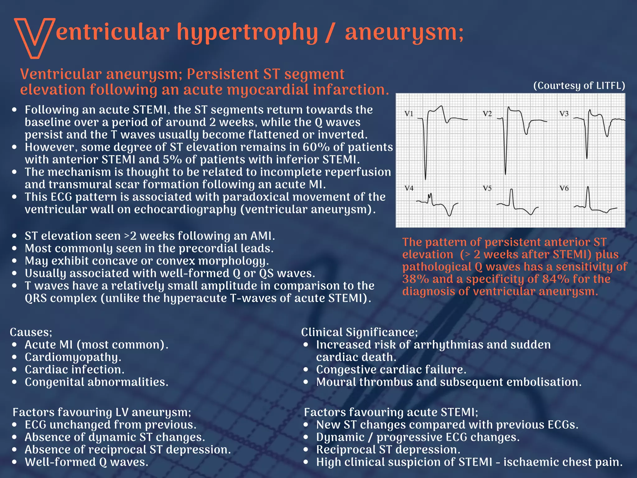 Stemi mimics v2 teaching resource | PDF