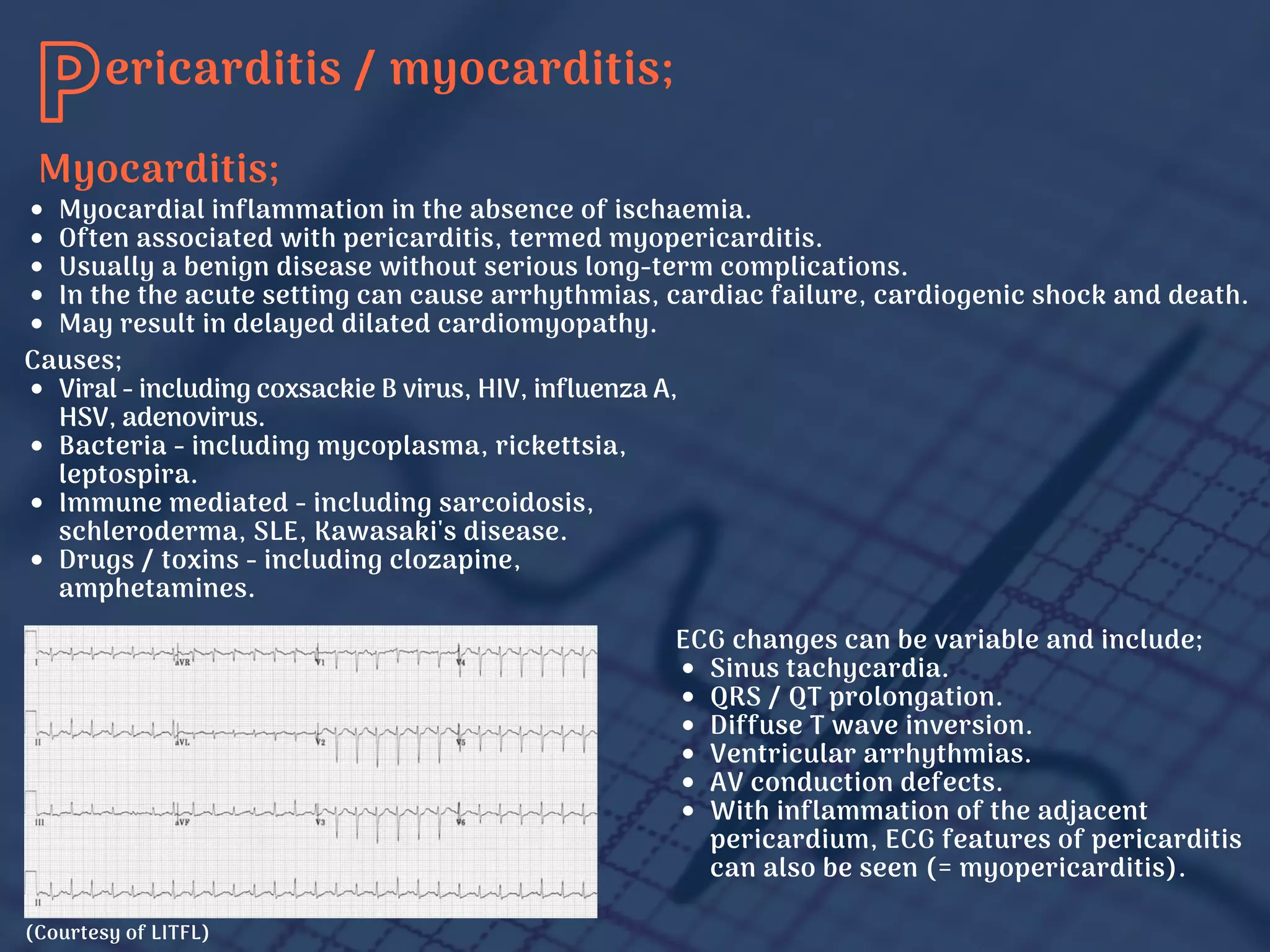Stemi mimics v2 teaching resource | PDF