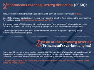 Stemi mimics v2 teaching resource | PPT