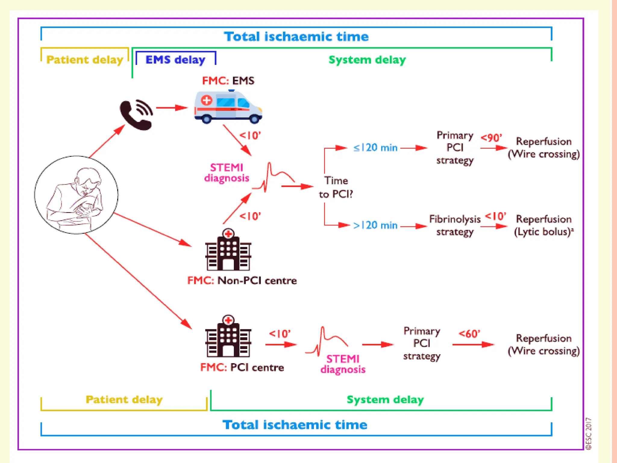 ppt on STEMI IN ICU, FOR acute coronary syndrome | PPTX