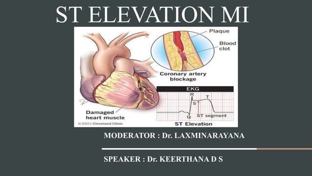 STEMI PPT for acute coronary syndome acute MI | PPT
