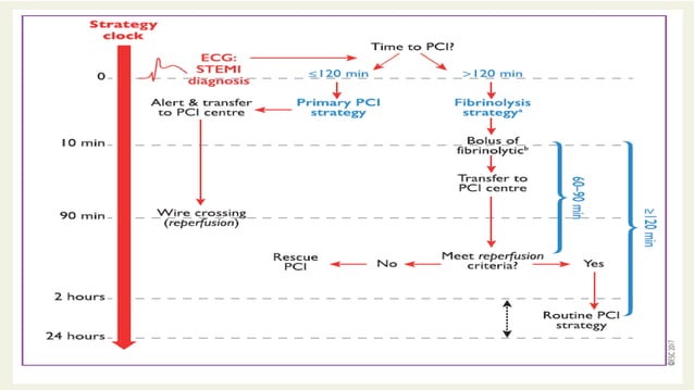 STEMI PPT for acute coronary syndome acute MI | PPTX | Heart and ...