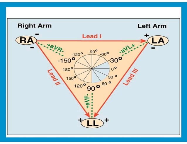 STEMI Training | PPT