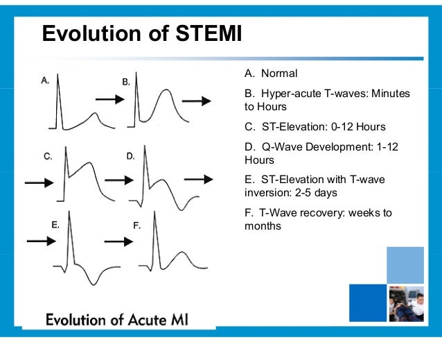 STEMI Training