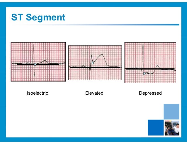 STEMI Training