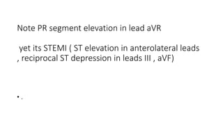 Stemi vs pericarditis ECG diagnosis | PPT
