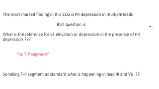 Stemi vs pericarditis ECG diagnosis | PPTX