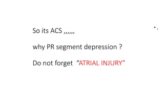 Stemi vs pericarditis ECG diagnosis | PPTX
