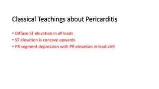 Stemi vs pericarditis ECG diagnosis | PPTX