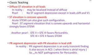 Stemi vs pericarditis ECG diagnosis | PPT