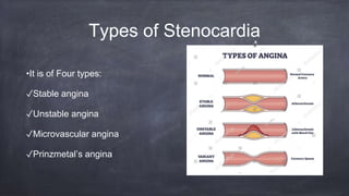 Stenocardia.pptx