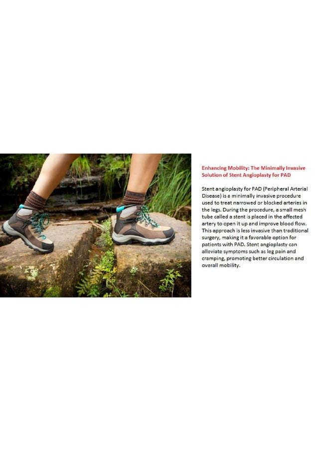 Stent Angioplasty for PAD: A Minimally Invasive Treatment Option | PDF