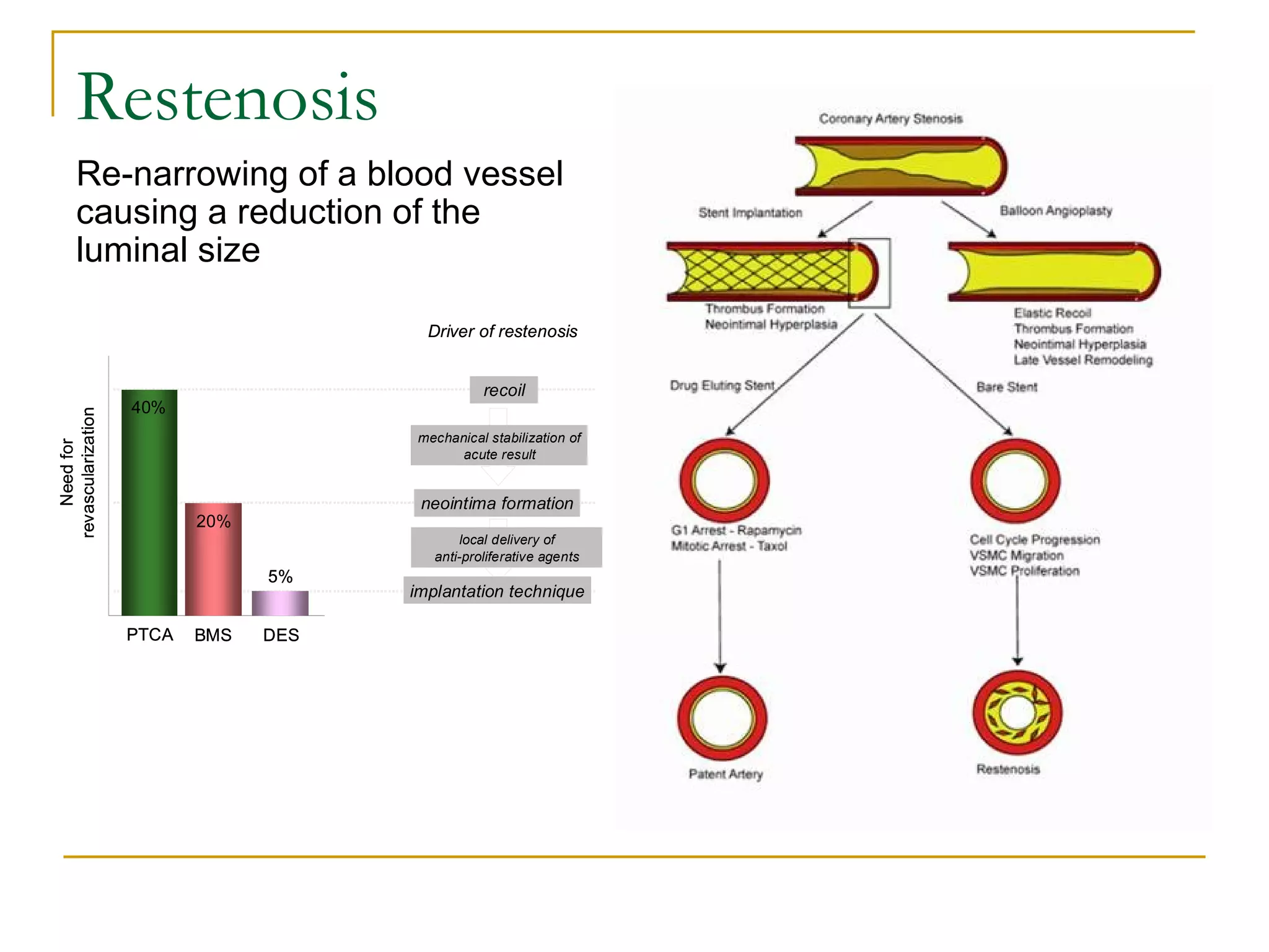 Coronary Stent - Part A - Overview | PPT