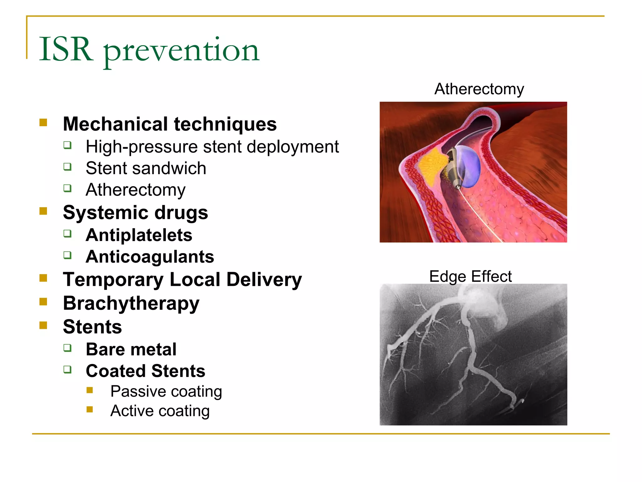 Coronary Stent - Part A - Overview | PPT
