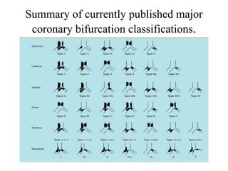 Stenting of bifurcation lesions | PPTX