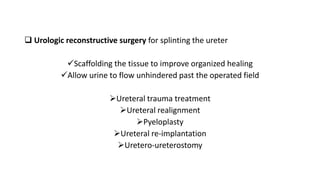 Stents in urology | PPTX