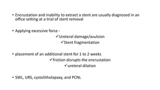 Stents in urology | PPTX
