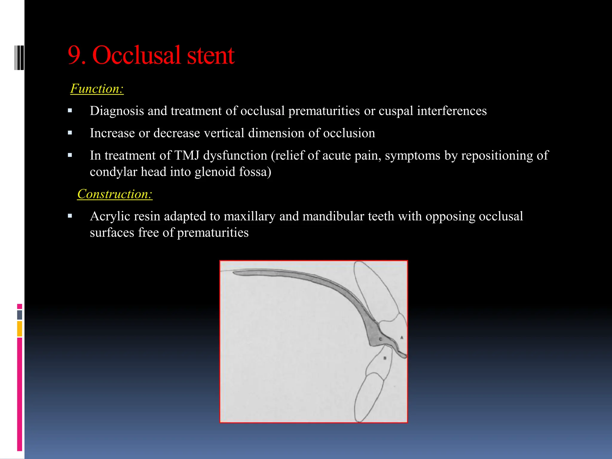 stents-splints.ppt surgical guides ppt s | PPT