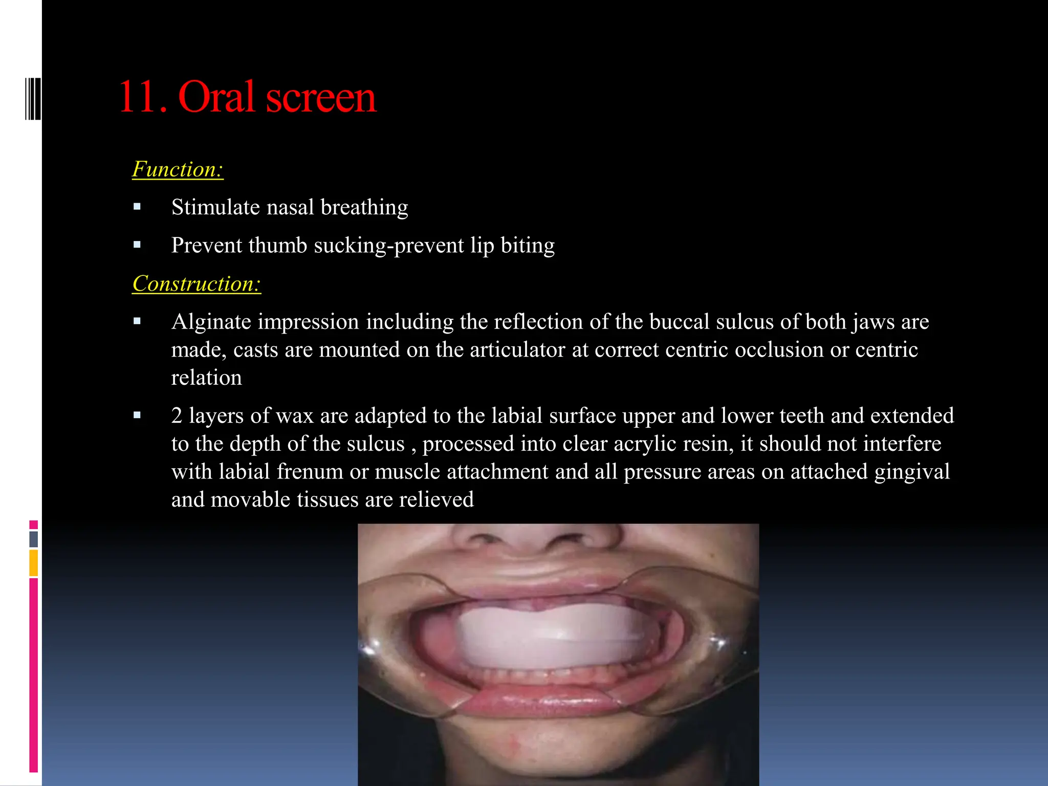 stents-splints.ppt surgical guides ppt s | PPT
