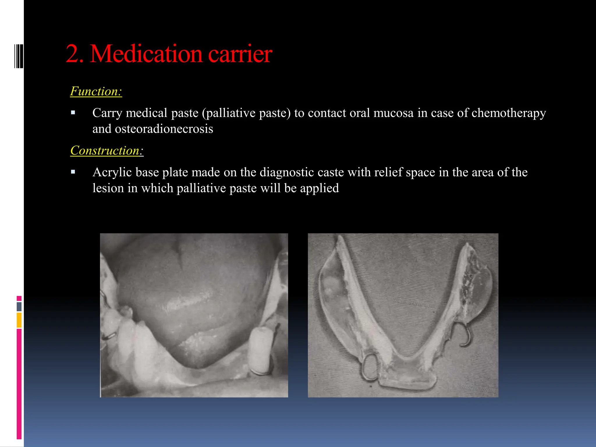 stents-splints.ppt surgical guides ppt s | PPT