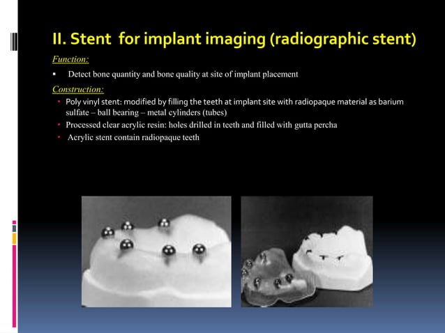 stents-splints.ppt surgical guides ppt s | PPT | Dental Health ...