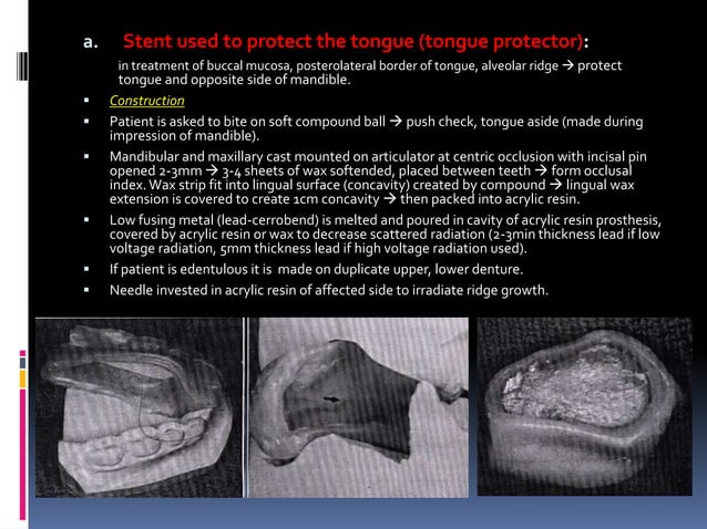stents-splints.ppt surgical guides ppt s | PPT | Dental Health ...