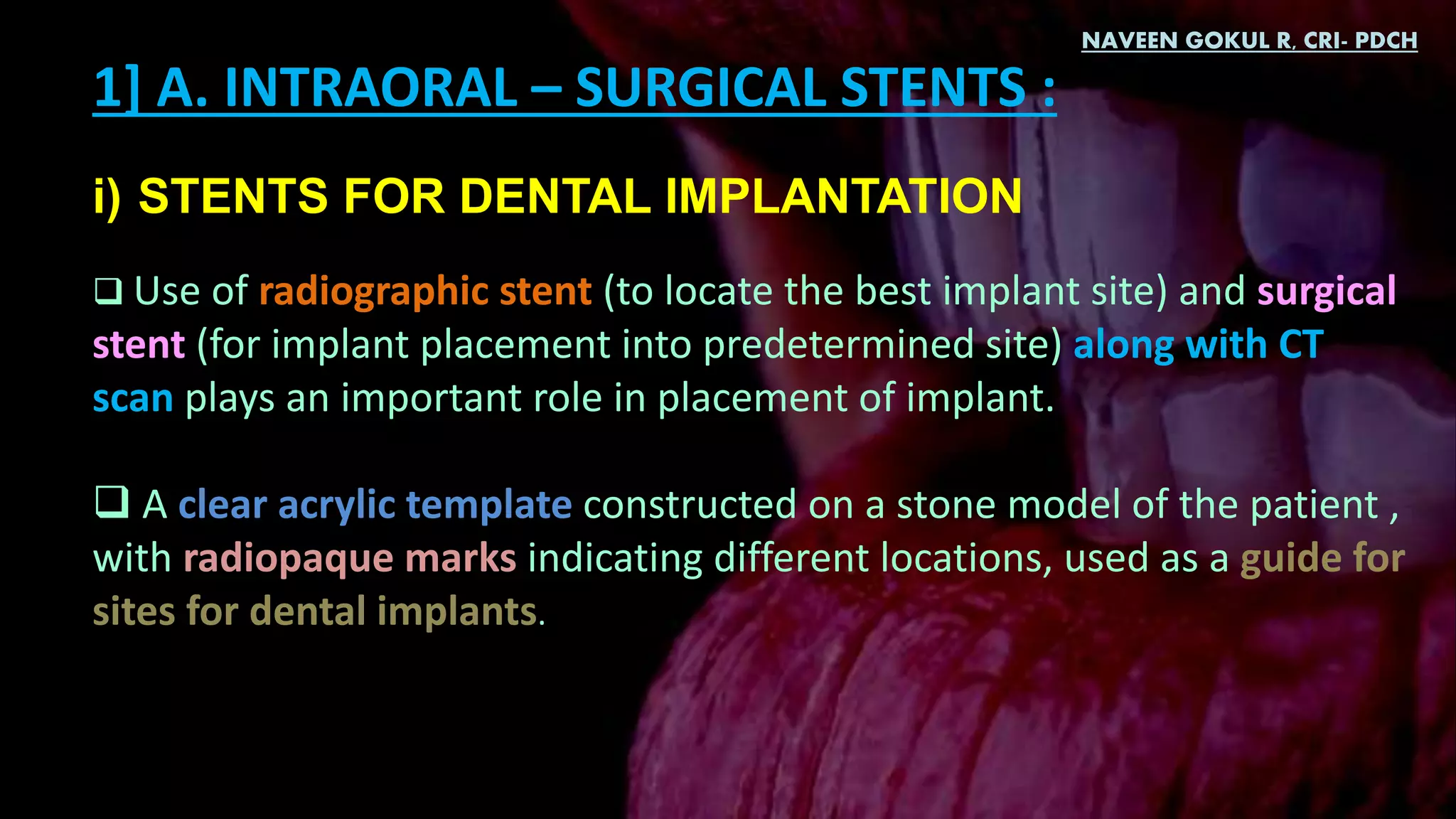 STENTS AND SPLINTS IN PROSTHODONTICS | PPTX