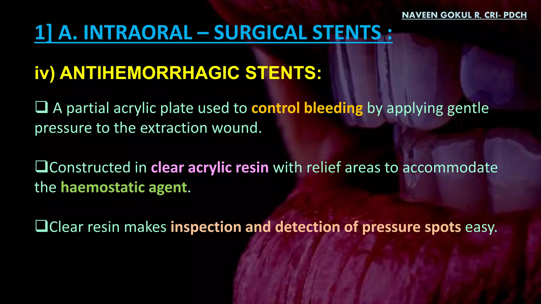 STENTS AND SPLINTS IN PROSTHODONTICS | PPTX