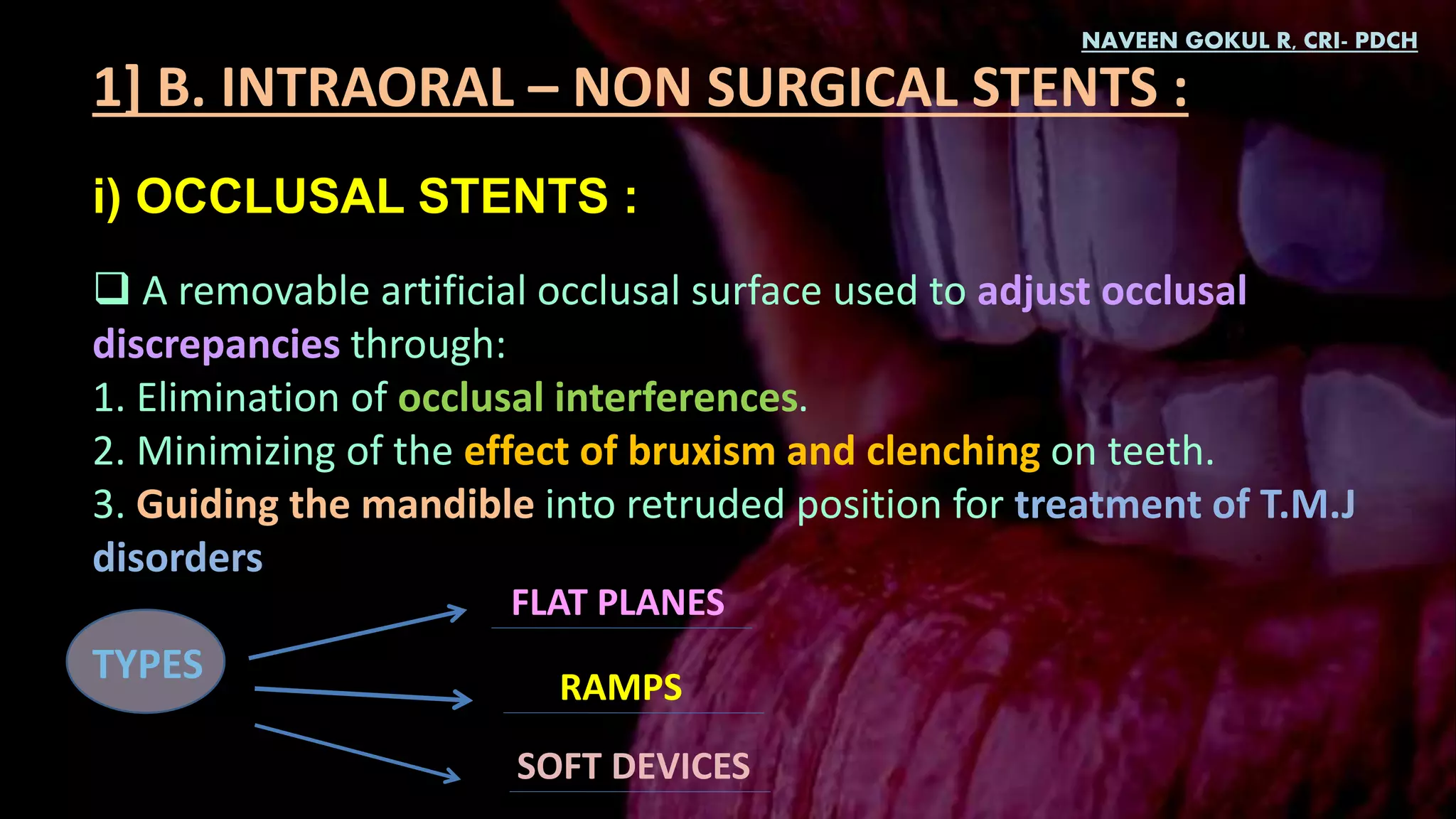 STENTS AND SPLINTS IN PROSTHODONTICS | PPTX