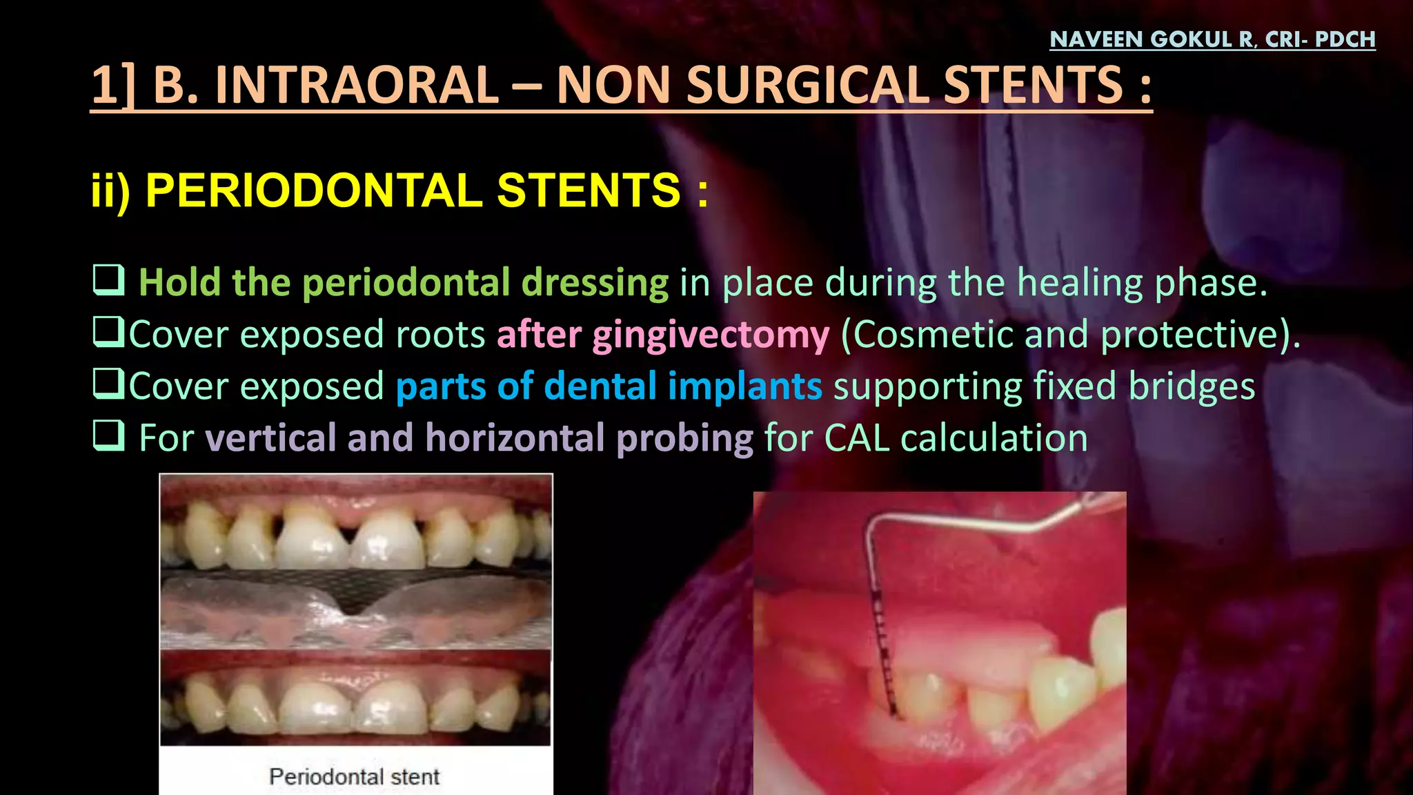 STENTS AND SPLINTS IN PROSTHODONTICS | PPTX