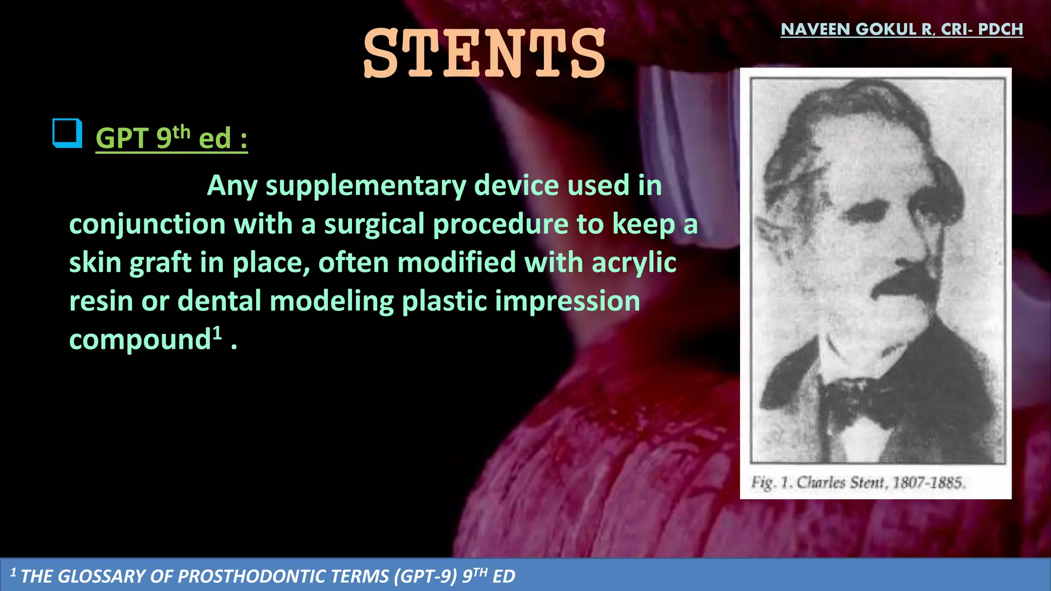STENTS AND SPLINTS IN PROSTHODONTICS | PPTX