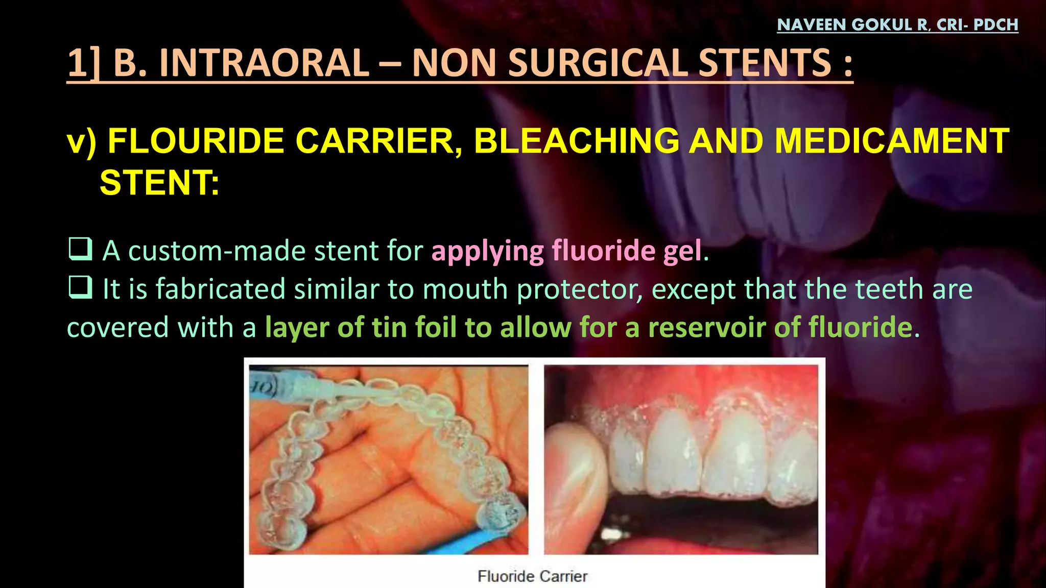 STENTS AND SPLINTS IN PROSTHODONTICS | PPTX