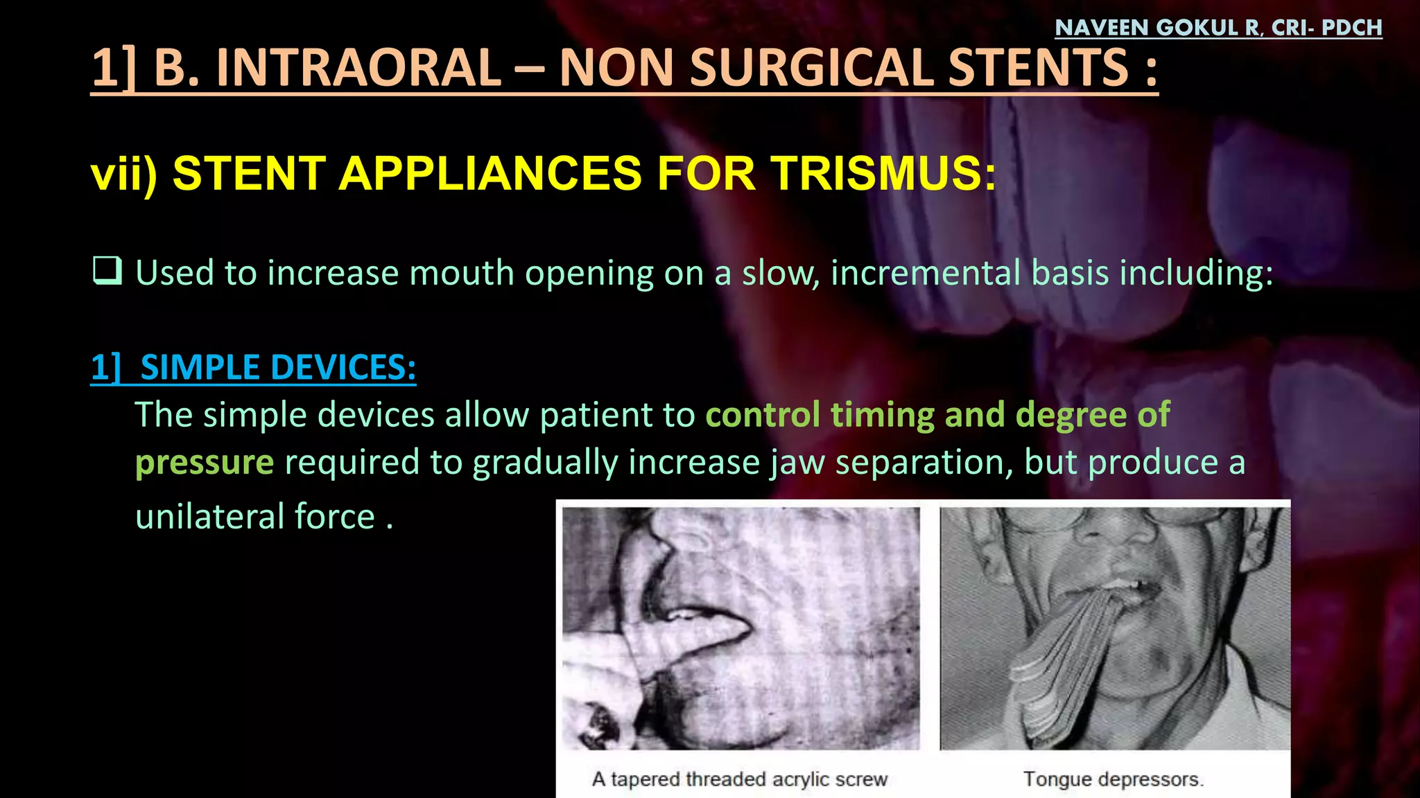 STENTS AND SPLINTS IN PROSTHODONTICS | PPTX