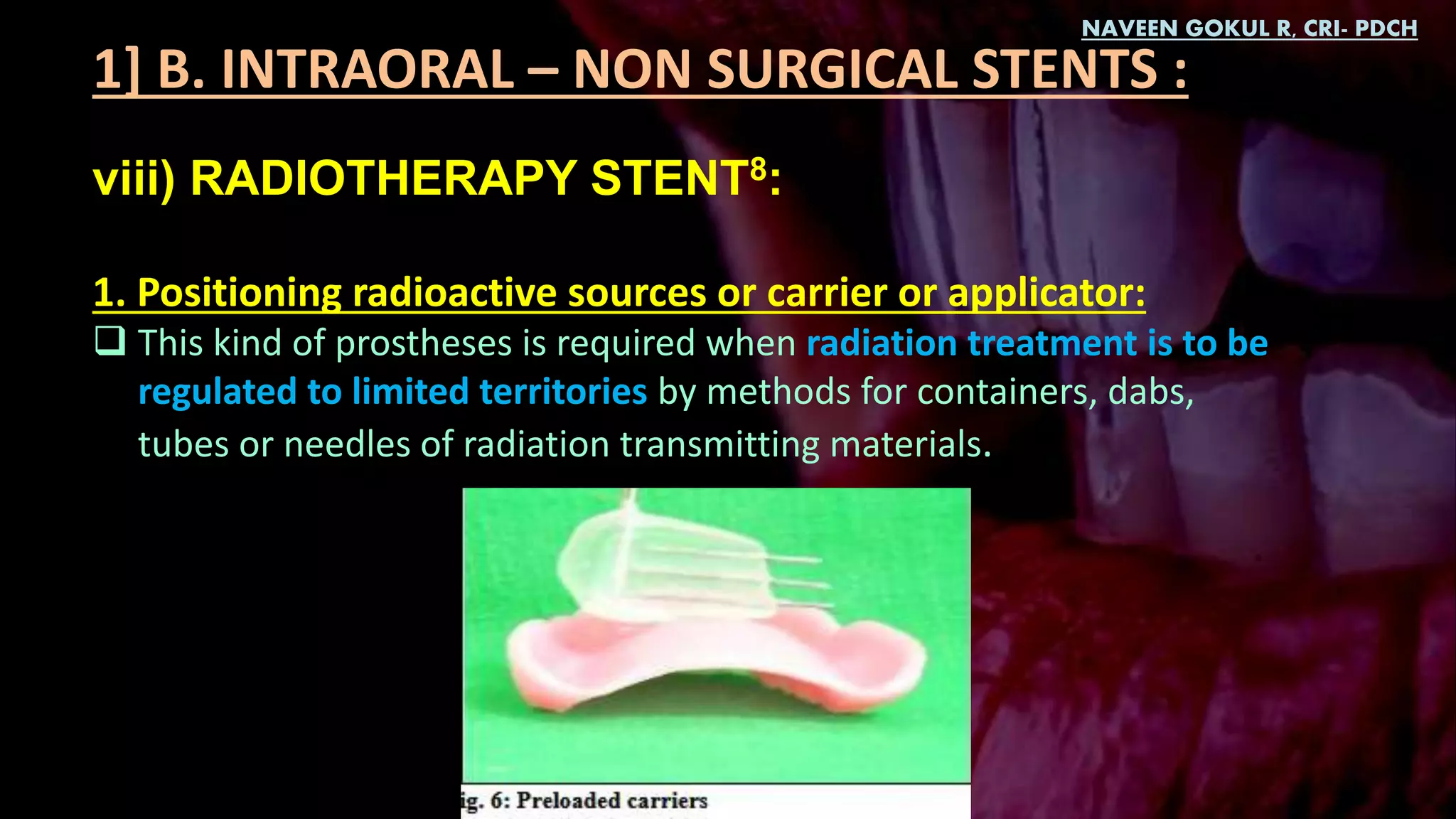 STENTS AND SPLINTS IN PROSTHODONTICS | PPTX