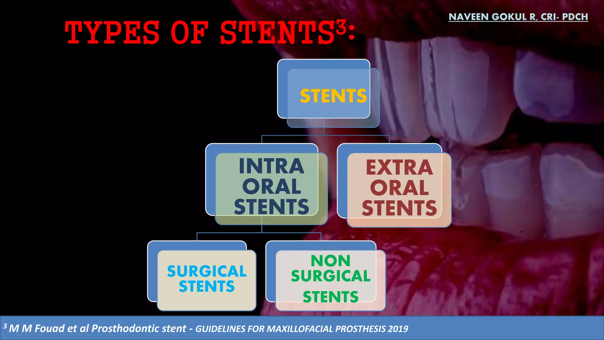 STENTS AND SPLINTS IN PROSTHODONTICS | PPTX