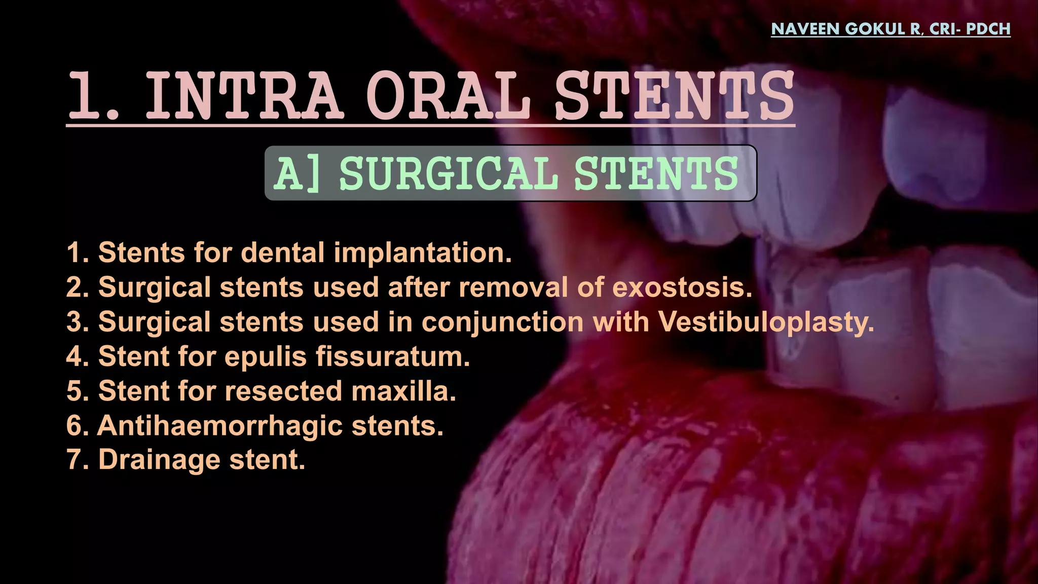 STENTS AND SPLINTS IN PROSTHODONTICS | PPTX