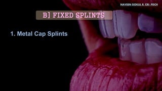 STENTS AND SPLINTS IN PROSTHODONTICS | PPTX
