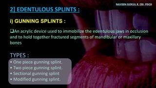 STENTS AND SPLINTS IN PROSTHODONTICS | PPTX