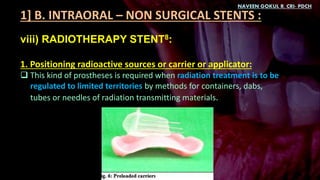 STENTS AND SPLINTS IN PROSTHODONTICS | PPT