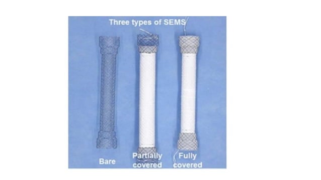 STENTS IN SURGERY.pptx