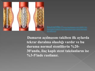 Stent ve nano stent | PPTX
