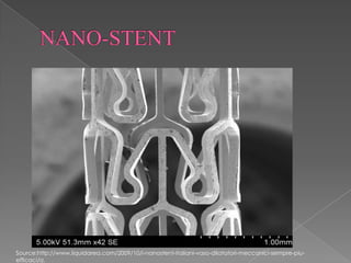 Stent ve nano stent | PPTX
